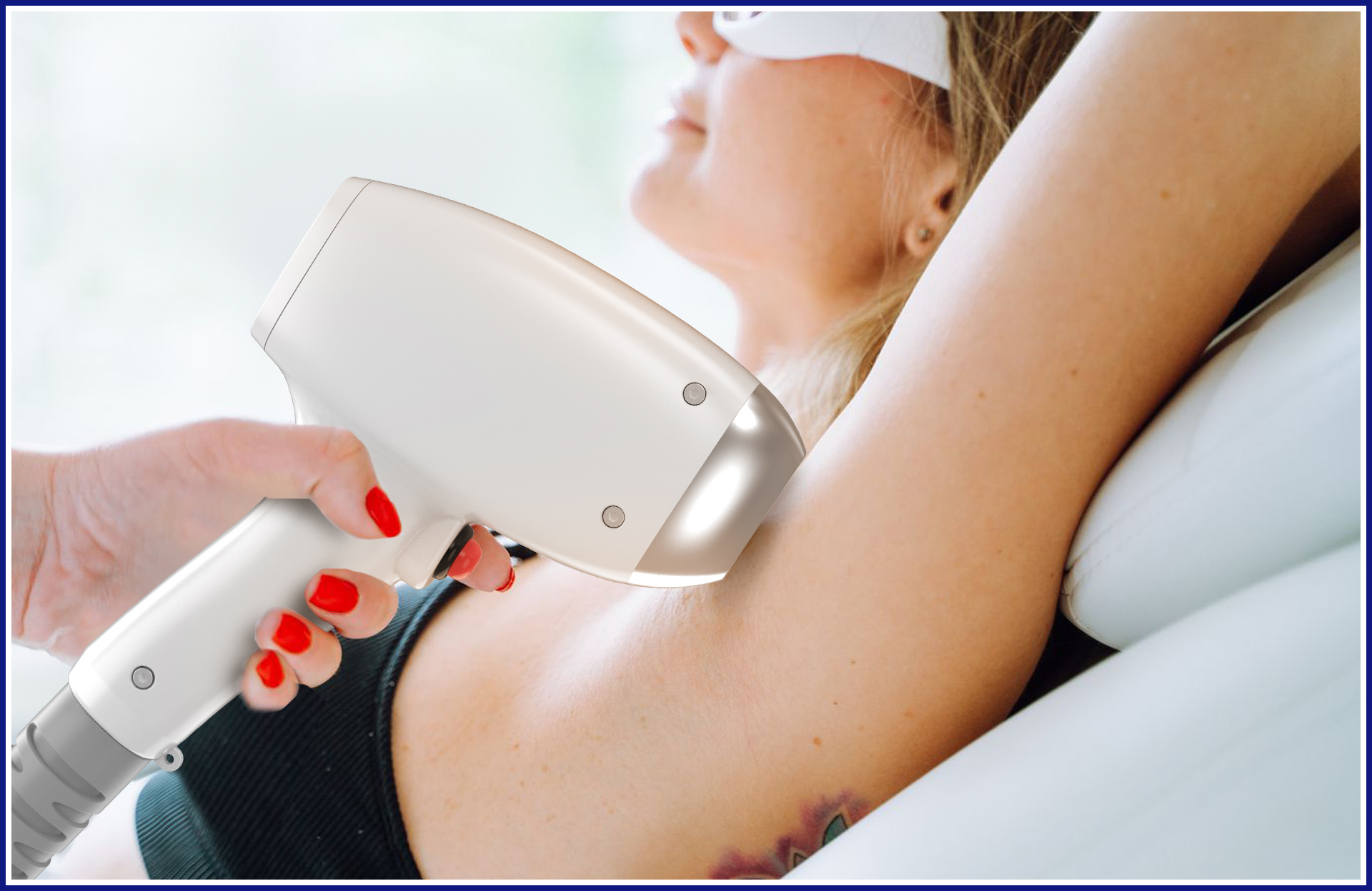 How Much Does Laser Hair Removal for Underarms Cost?