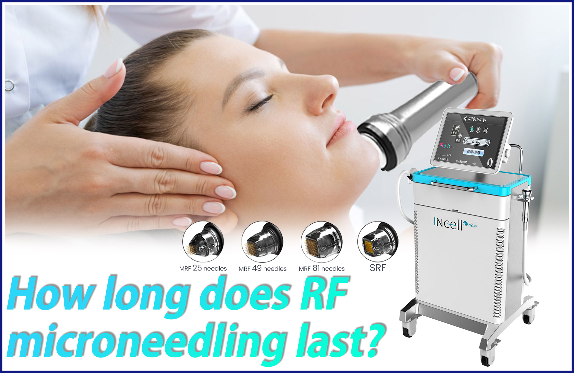 How Long Does RF Microneedling Last?